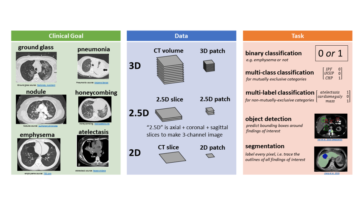 Chest CT Scan Machine Learning in 5 minutes – Glass Box