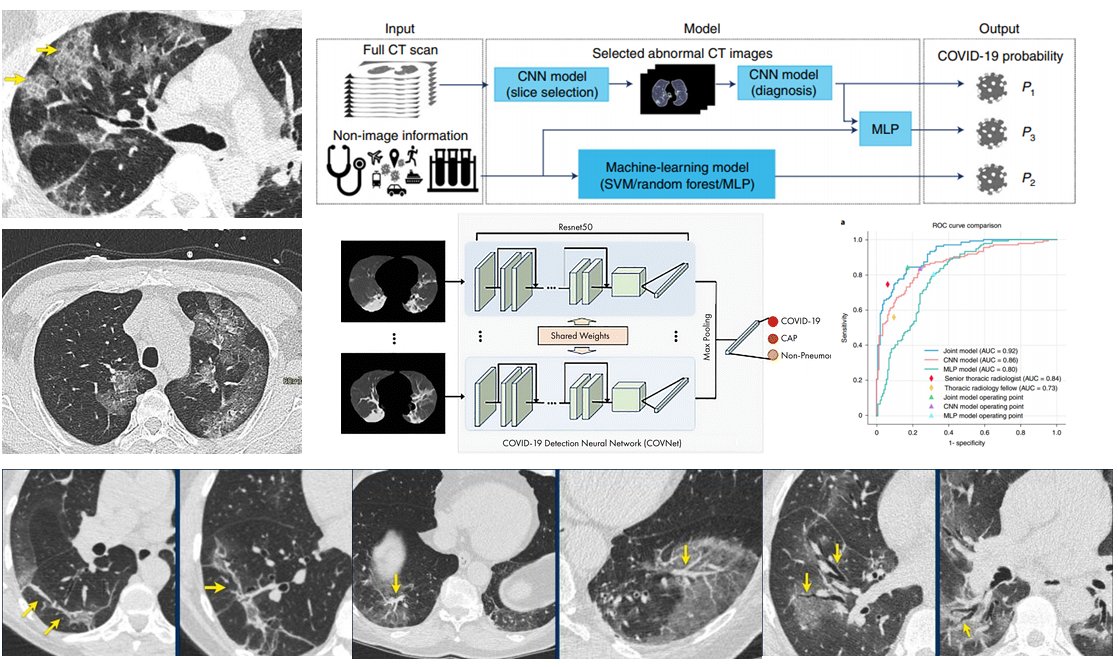 COVID-19 Chest CT Scan Analysis: Clinical Recommendations and Machine ...