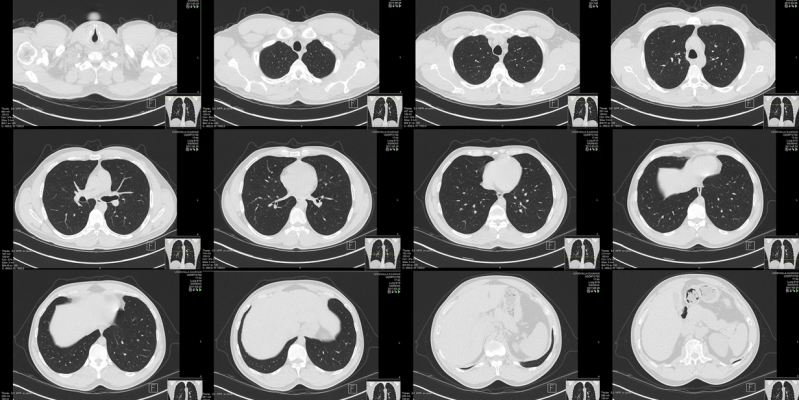 ct-scan – Glass Box Medicine